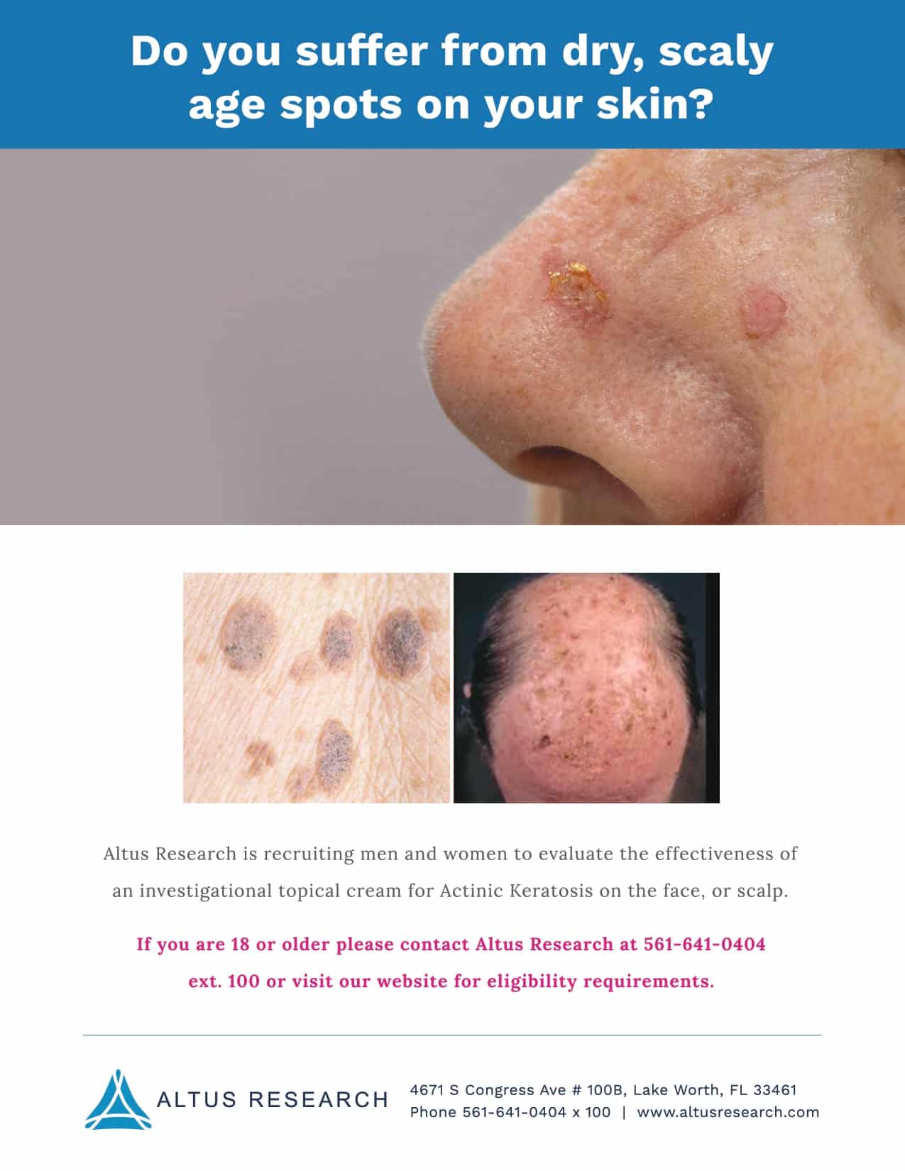 Actinic Keratosis Volunteers Near Lake Worth Florida